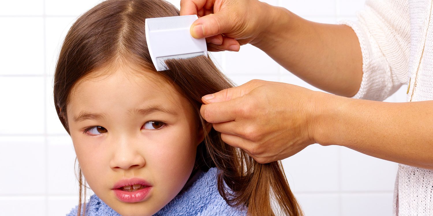 Head lice and nits: did lockdown reduce cases in the past year? - Which?