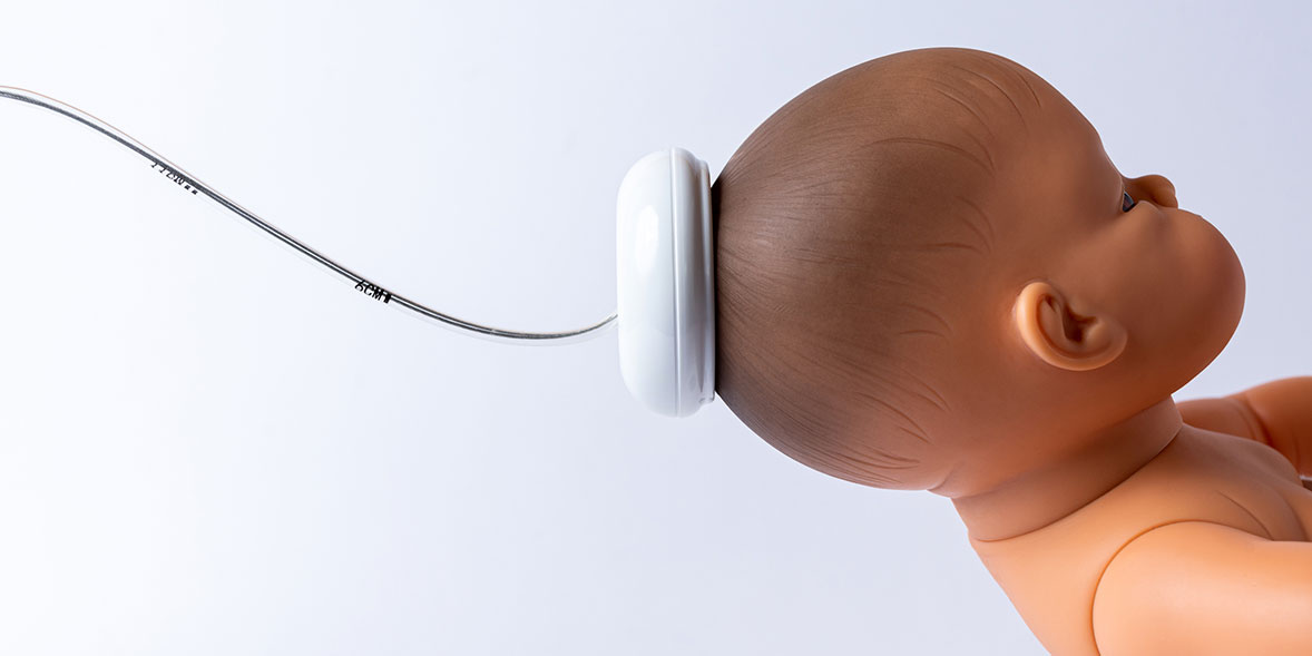 Inductions and interventions in labour - Which?